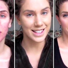 Cassandra Bankson Acne Scar Cover Up Makeup Tutorial